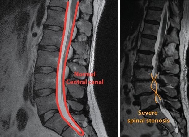Spine MRI Scan – Best Scan Centres, Blood Test & Diagnostic Labs Near You