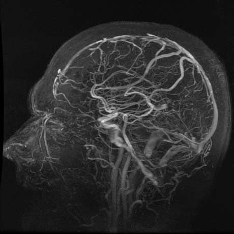 MRI Angiography – Best Scan Centres, Blood Test & Diagnostic Labs Near You